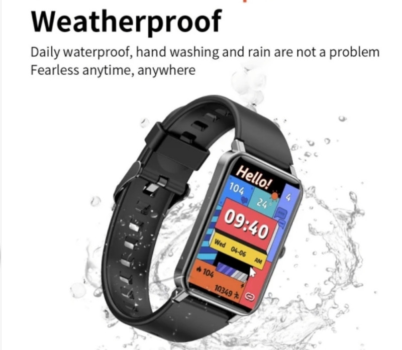 Xiaomi smart wach - Smartwatch (pametni satovi) - OLX.ba