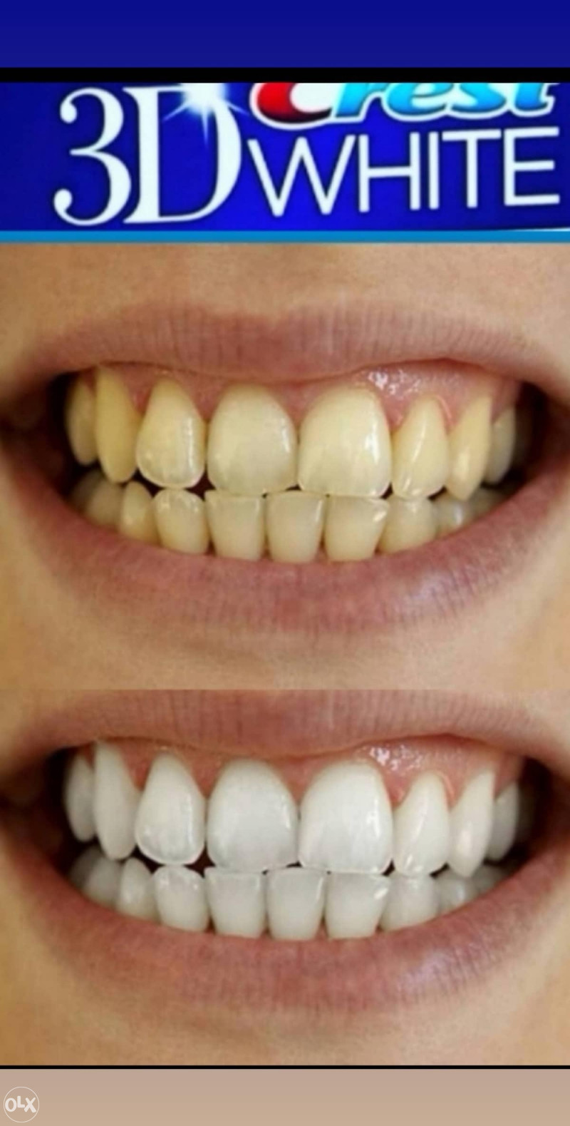 CREST 3D White Lux trakice, Crest 3D White pasteORGINAL - Izbjeljivanje ...